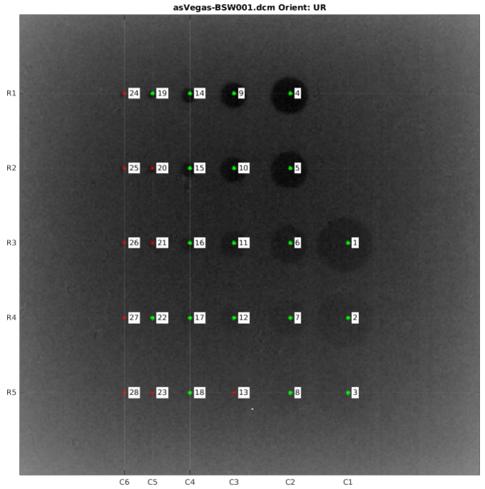 Planar MV Imaging (Las Vegas) – Standard Imaging