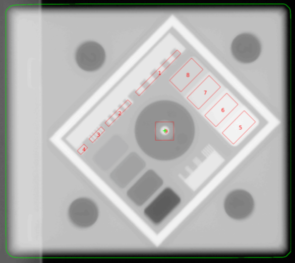 Planar MV Imaging (Doselab MV) – Standard Imaging